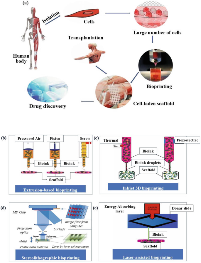 Drug Delivery to the Musculoskeletal System: Localized Therapies and ...