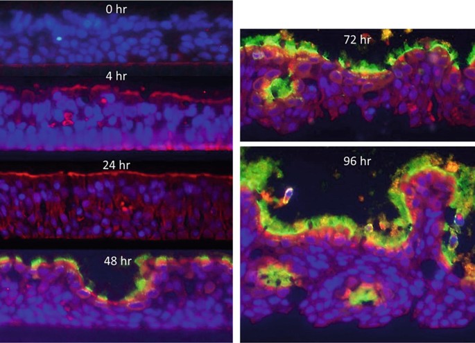 Well-Differentiated Primary Human Airway Epithelial Cultures for ...