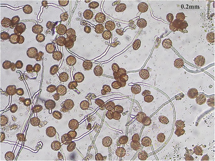 Pollen Cryopreservation of Brownea grandiceps Jacq. | Springer Nature Link