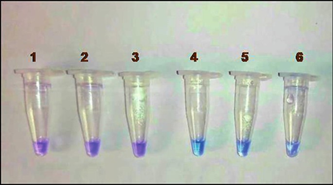 One-Step RT-LAMP: A Method for Closed-Tube Colorimetric Detection of ...
