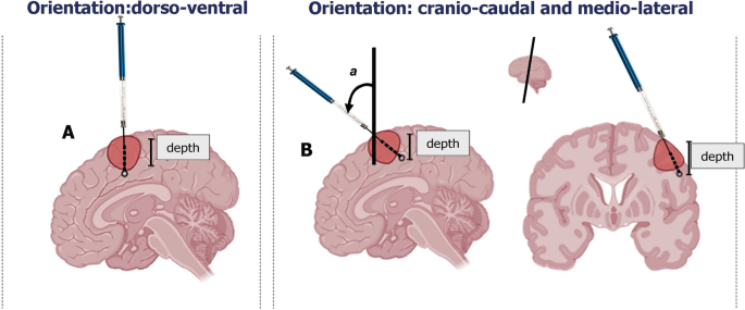 Intracerebral Transplantation of Enteric Glia | SpringerLink