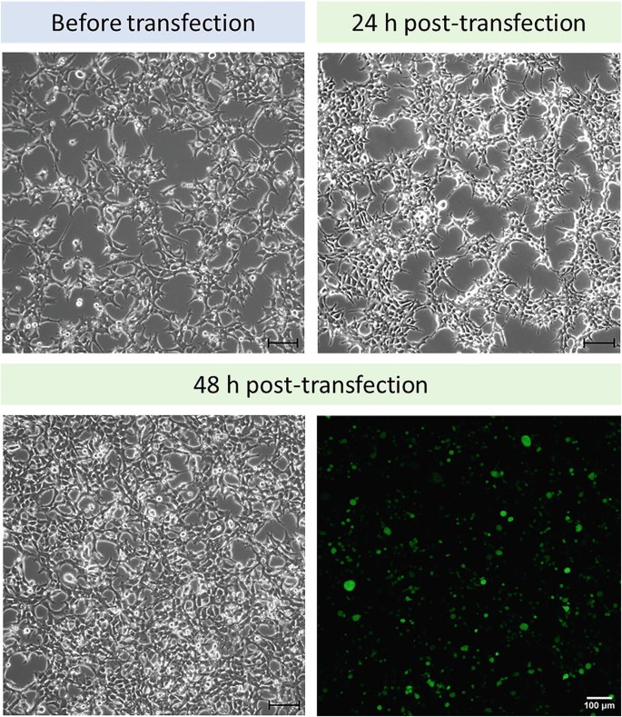 Development of a Gene Therapy with Lentiviral Vectors for ...