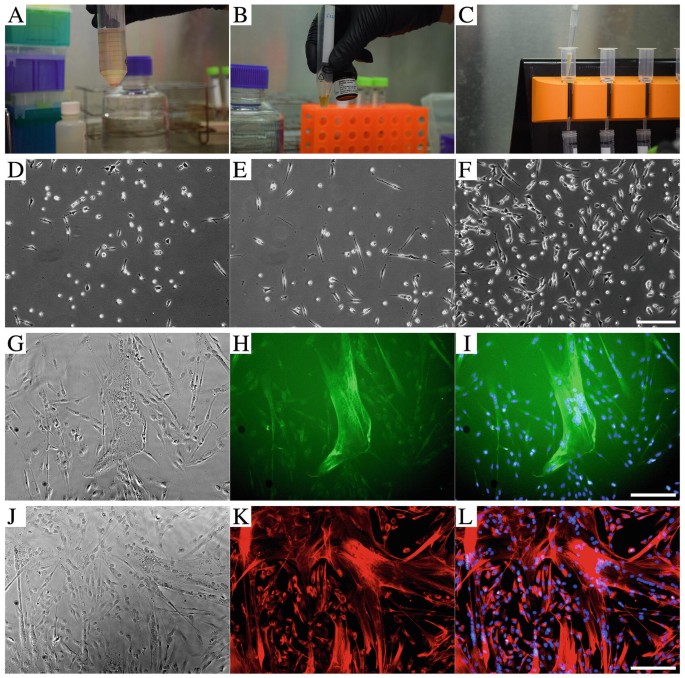 Isolation and Culture of Primary Myoblasts from Humans and Mice ...