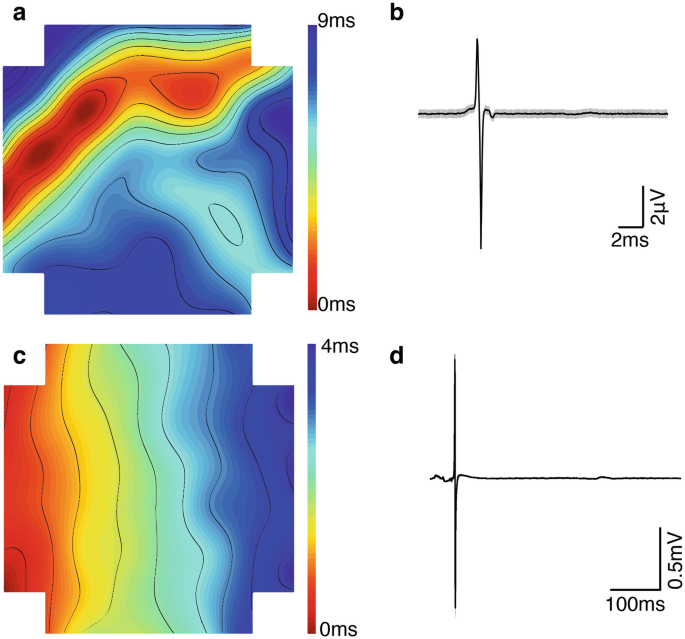 Culture and Electrophysiological Analysis of Patient-Specific iPSCs ...