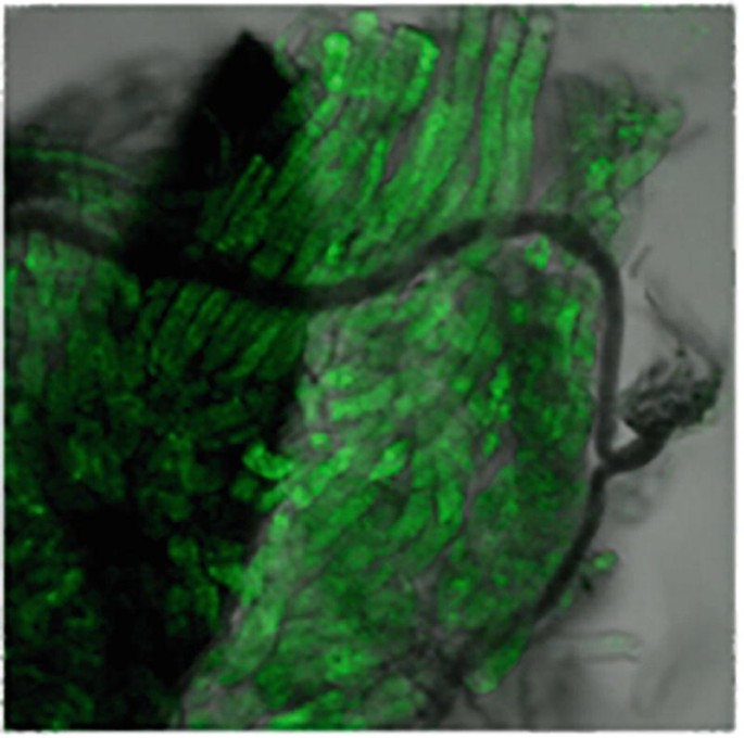 In Vivo Electroporation of Plasmid DNA into the Skeletal Muscle of ...