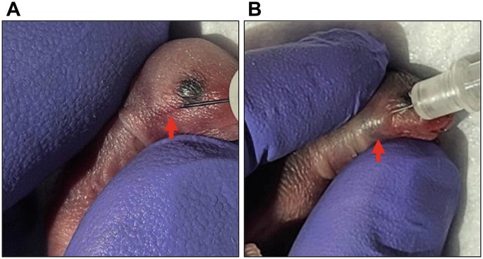 Intramuscular and Intravenous AAV-Mediated Gene Delivery in Mouse ...