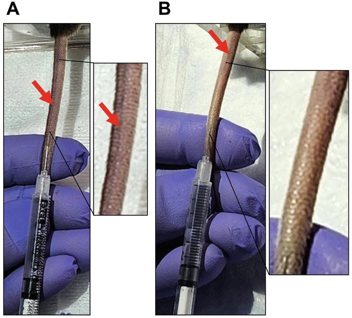 Intramuscular and Intravenous AAV-Mediated Gene Delivery in Mouse ...