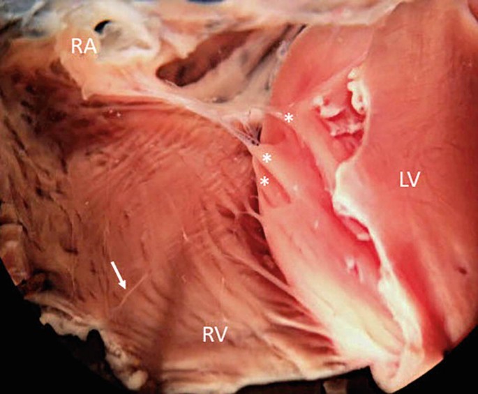 Assessment of Contractile and Kinetic Properties of Skeletal and ...