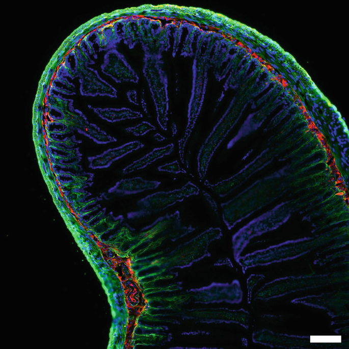 Immunostaining Methods for Lysosomal Storage Disorder Research ...