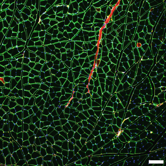 Immunostaining Methods for Lysosomal Storage Disorder Research ...