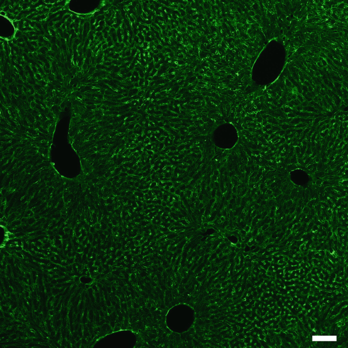 Immunostaining Methods for Lysosomal Storage Disorder Research ...