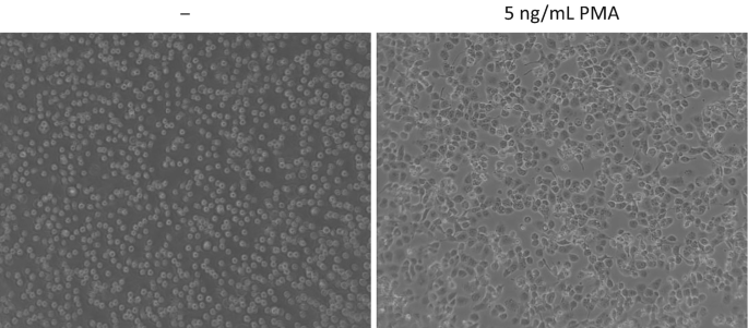 Differentiation and Polarization of THP-1 Cells into M1 and M2 ...