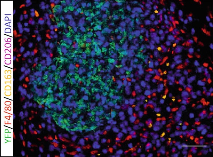Immunohistochemistry and Immunofluorescence Approaches in Cancer ...