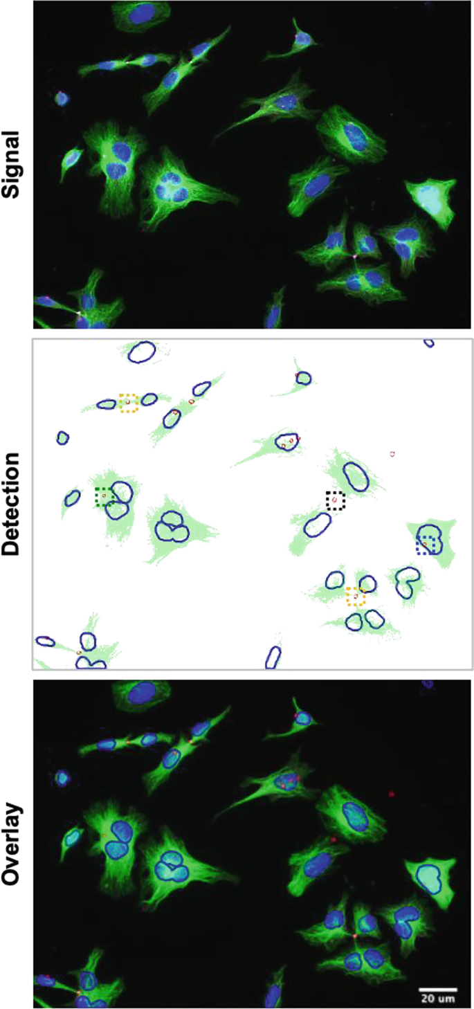 Semi-automated Detection of Late Cytokinetic Bridges | Springer Nature ...