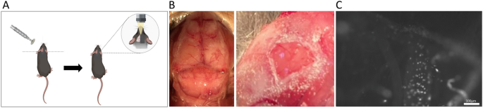 Intravital Microscopy of Mesenteric and Brain Vessels: A Valuable Tool ...