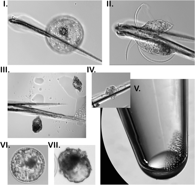 Handmade Biopsies and Whole Genome Amplification for Genotyping and ...