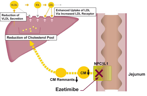 Cholesterol Absorption Inhibitor Ezetimibe: Risk–Benefits and Role in ...