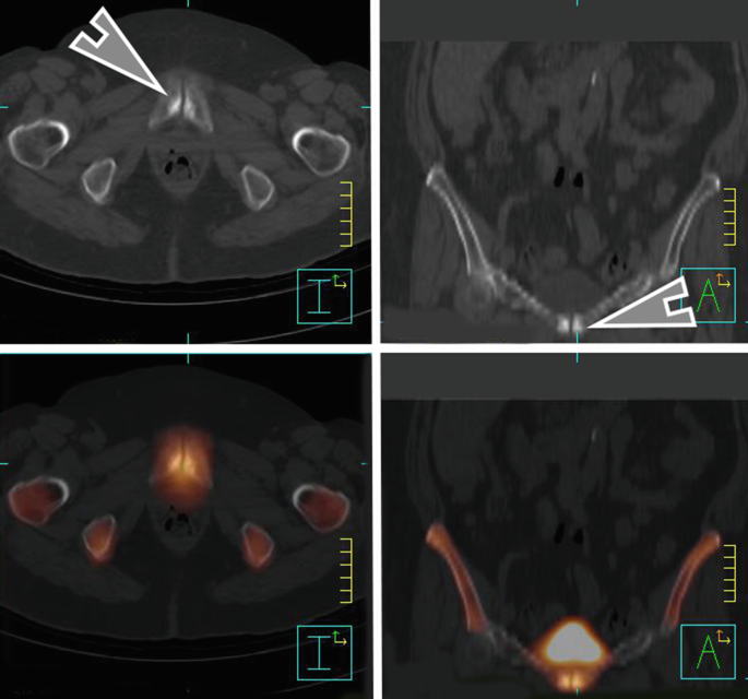Anterolateral Pelvic and Groin Pain | SpringerLink