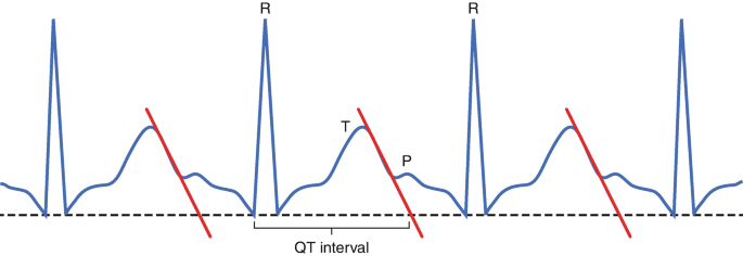 Pediatric Exercise Testing | SpringerLink