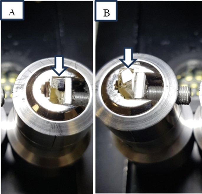 Semi-Thin Section Preparation for Electron Microscopy in Renal ...