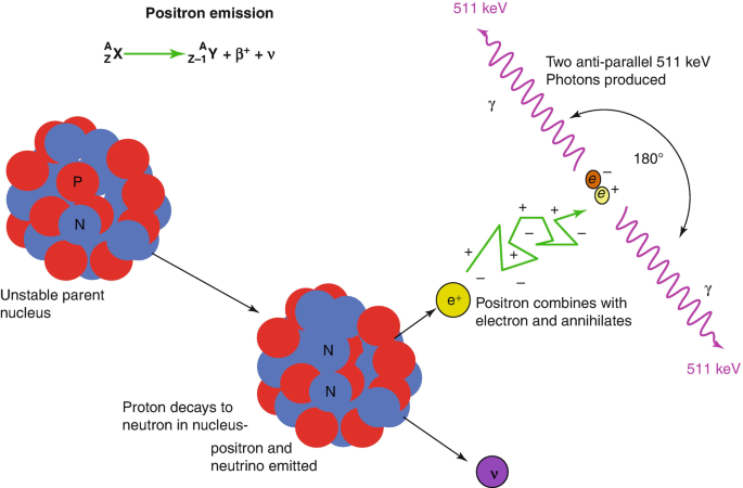 What Is Positron Emission Tomography? | SpringerLink