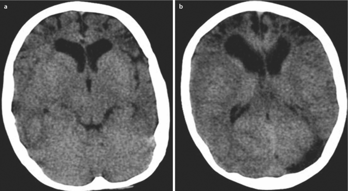 Neurology | SpringerLink