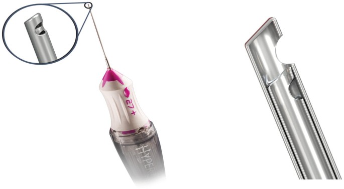 Vitrectomy Principles and Systems | SpringerLink