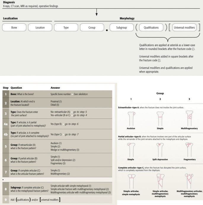 Articular Fractures | Springer Nature Link (formerly SpringerLink)