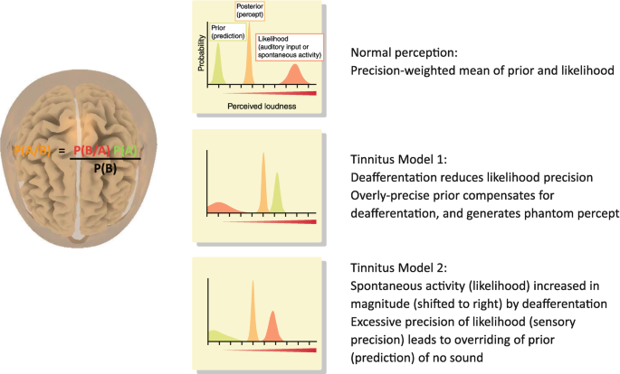 The Bayesian Brain and Tinnitus | SpringerLink