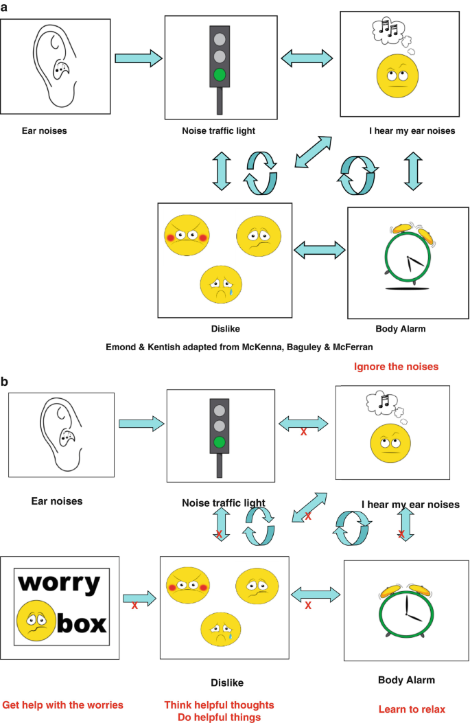 Tinnitus in Children and Adolescents | SpringerLink