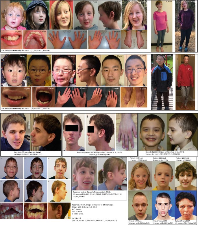 Zahir Friedman Syndrome | SpringerLink
