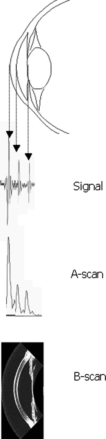 Physical Principles of Ultrasound Propagation and Image Formation ...