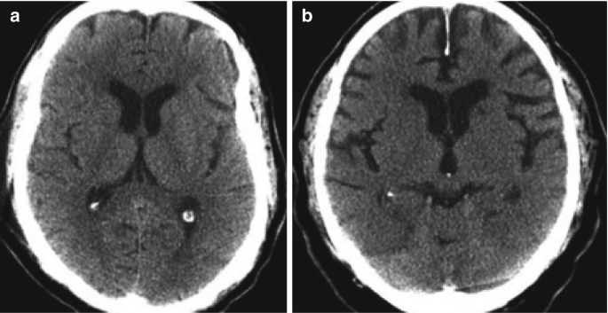 Neurorehabilitation Testing, Metrics, and Procedures in Acquired Brain ...