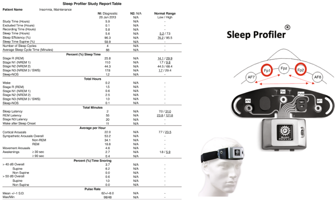 Monitoring of Sedation and Sleep in Intensive Care Unit | Springer ...