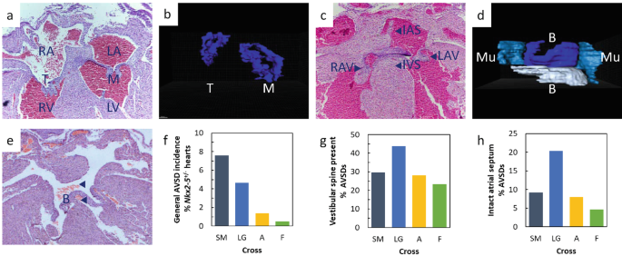 Molecular Pathways and Animal Models of Atrial Septal Defect | SpringerLink