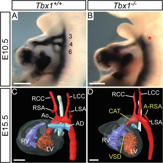 Molecular Pathways and Animal Models of Truncus Arteriosus | SpringerLink