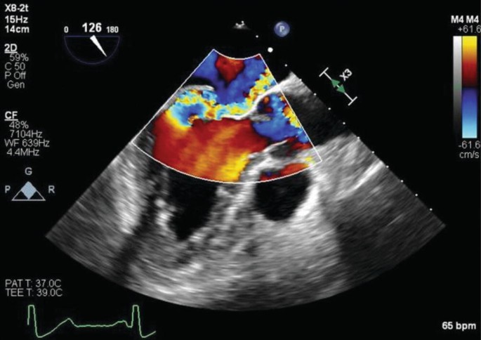 Doppler | SpringerLink