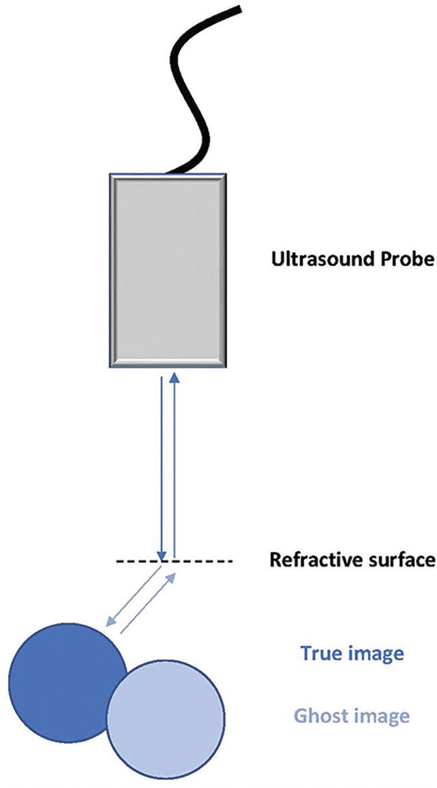 Knobology, Image Acquisition, Optimization and Artifacts | SpringerLink