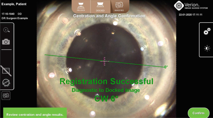 Argos Verion Image-Guided System | SpringerLink