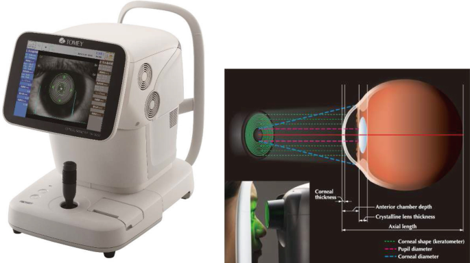Optical Biometer OA-2000 | SpringerLink