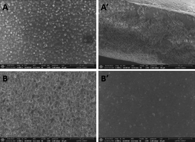 Elaboration and Characterization of Cellulose Acetate Film with Natural ...