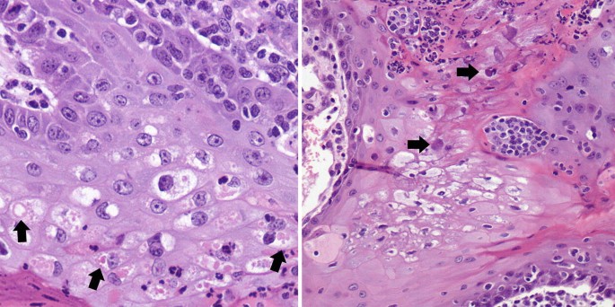 Orf Virus Infection in Small Ruminants | SpringerLink