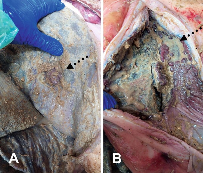 Abomasal Ulcers in Adult Cattle | Springer Nature Link (formerly ...