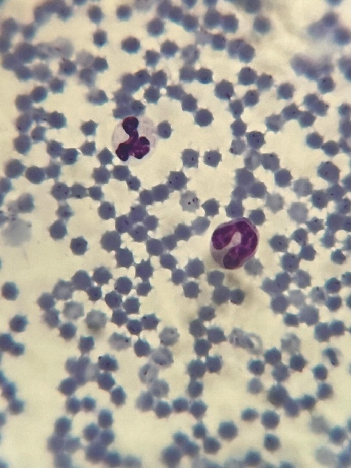 Anemia in Cows | SpringerLink