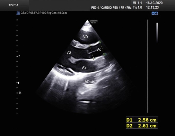 Transthoracic and Transesophageal Echocardiography | SpringerLink