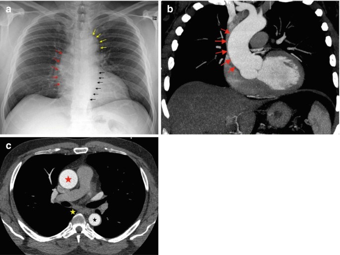 Anatomical Landmarks: Lines and Stripes | SpringerLink