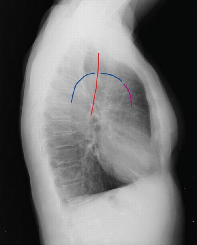 Anatomical Landmarks: Lines and Stripes | SpringerLink