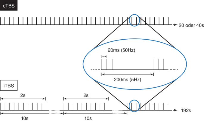 Theta-Burst-Stimulation (TBS) | SpringerLink