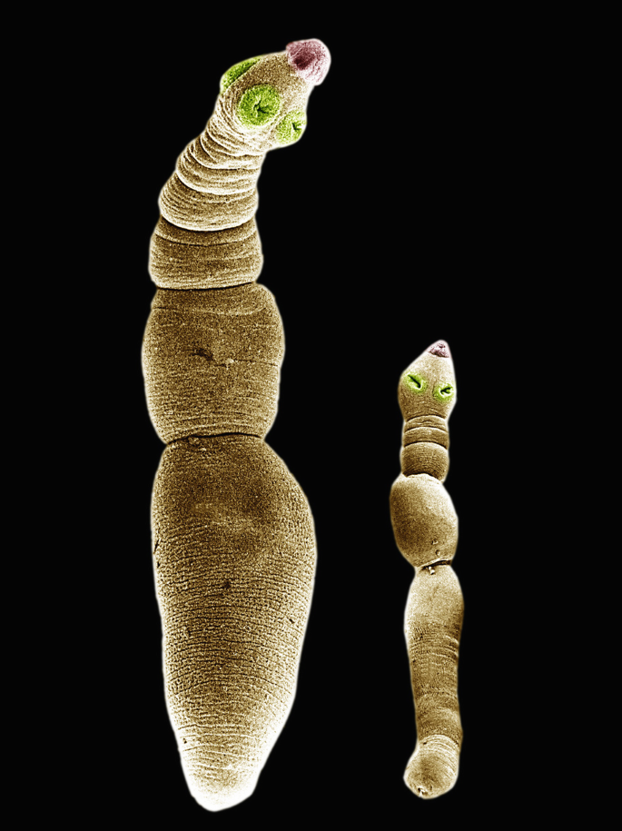 Light and Electron Microscopical Aspects of Stages of Echinococcus ...