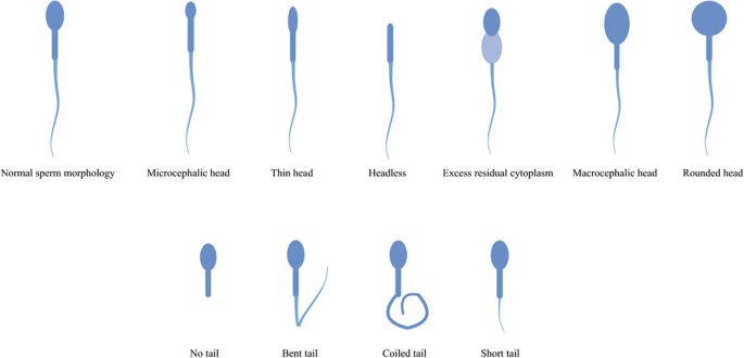 Sperm Morphology | SpringerLink